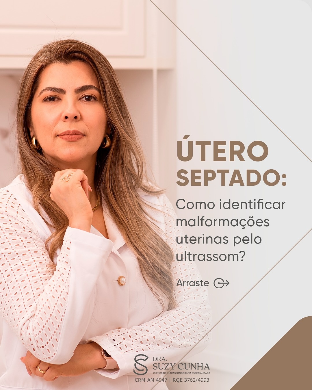 Você já ouviu falar sobre “útero septado”? - Dra. Suzy Cunha ...